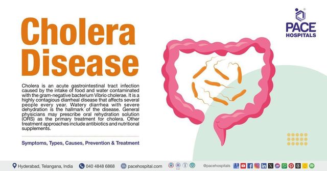 EXPLAINER: What to know as Cholera resurges in Nigeria - FactWatch